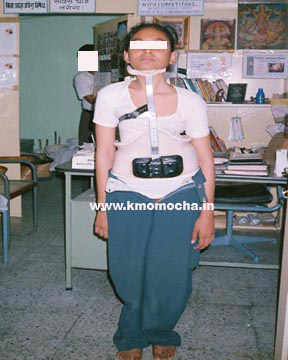 ORTHOTICS PROSTHETICS RESEARCH